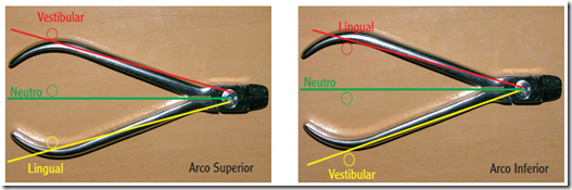 Ortopress.com: A importância da incorporação e do controle de torque no ...